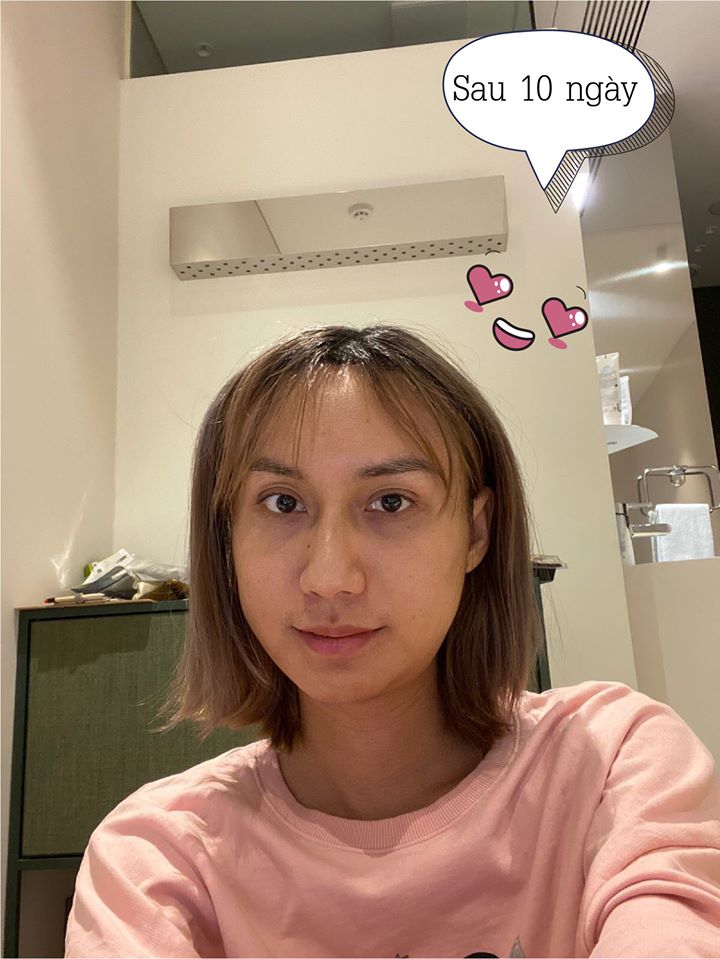 Lynk Lee bất ngờ công khai loạt hình ảnh về quá trình phẫu thuật chuyển ...