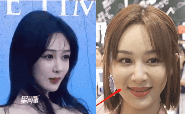 Dương Tử Trong ảnh Chưa Chỉnh Sửa Lúc Xinh Tỏa Sáng Lúc Lộ Di Chứng Dao Kéo