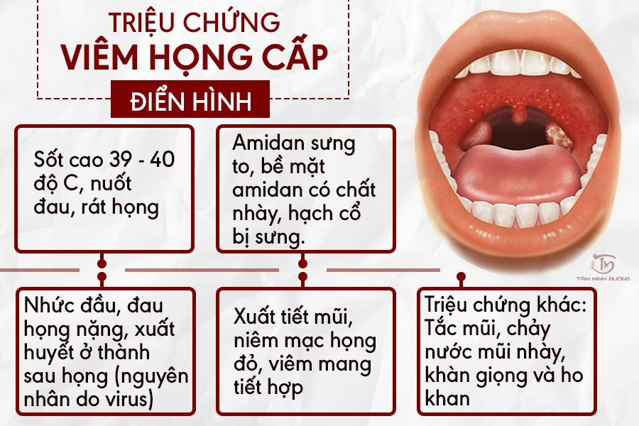 Viêm họng là gì? Cách chữa bệnh viêm họng hạt, cấp và mãn tính
