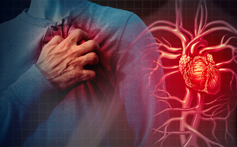 Triệu chứng của đau tim