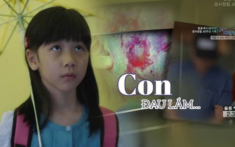 Phim Hope Dựa Trên Chuyện Có Thật: Tìm Hiểu Về Câu Chuyện Cảm Động