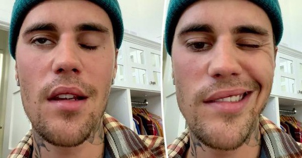 Justin Bieber rất hoảng sợ và lo lắng về tác dụng phụ của hội chứng gây ...